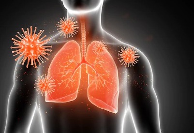 Vape Habit can Trigger Bronchitis! – jabarekspres.com