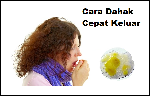 Cara Dahak Cepat Keluar Yang Perlu Kamu Ketahui! – jabarekspres.com