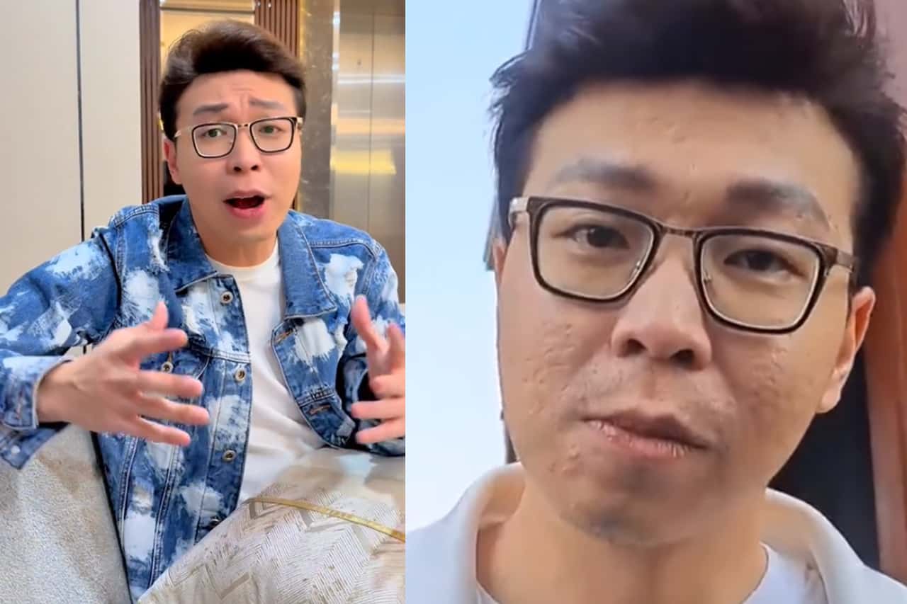 Klarifikasi dr Richard Lee Tentang Mukanya yang Bopeng – jabarekspres.com
