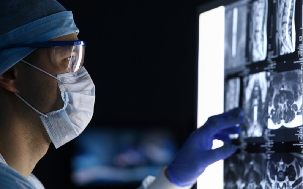 Memahami Dokter Bedah Saraf dan Fungsinya, Sudah Tahukah? – jabarekspres.com