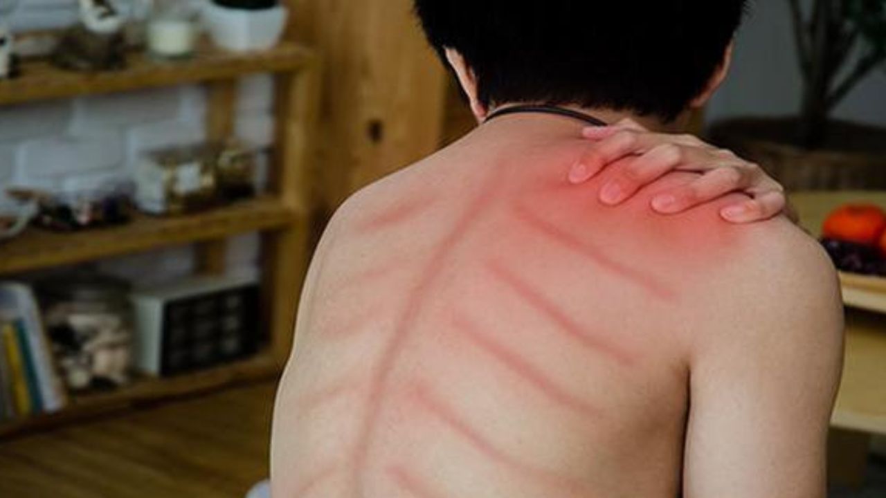 Mengenal Masuk Angin: Penyebab, Gejala, dan Cara Mengatasinya – Radar Garut