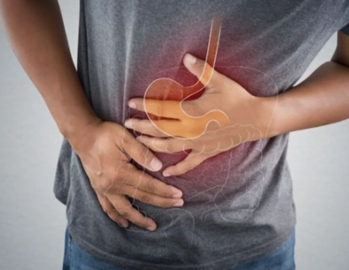 Cari Tau Apa Itu Penyakit GERD? Ini Dia Penjelasannya – Radar Garut