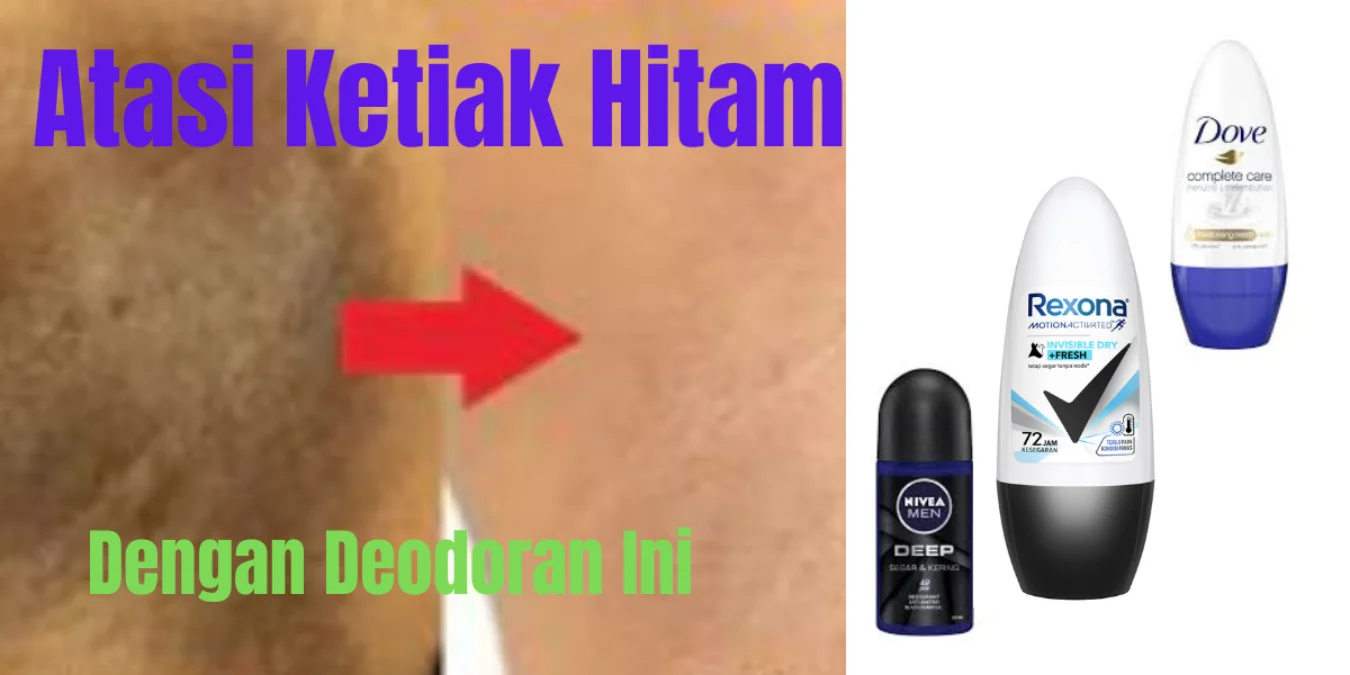 Kamu Tidak Perlu Khawatir Lagi Dengan Ketiak Hitam, Ini 5 Deodoran Paling Ampuh untuk Mengatasi ...