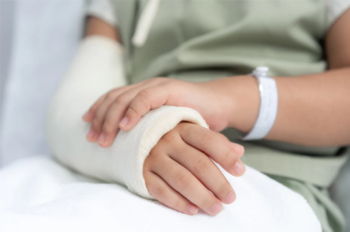 Perbedaan Gips Fiberglass dan Gips Plester dan Cara Merawat Gips ...